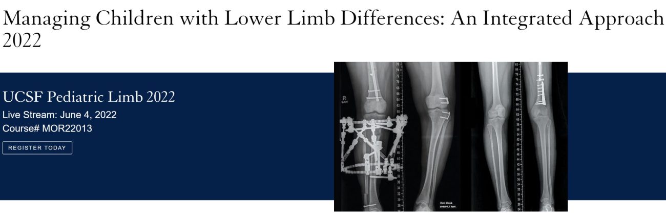 Managing Children With Lower Limb Differences: An Integrated Approach ...