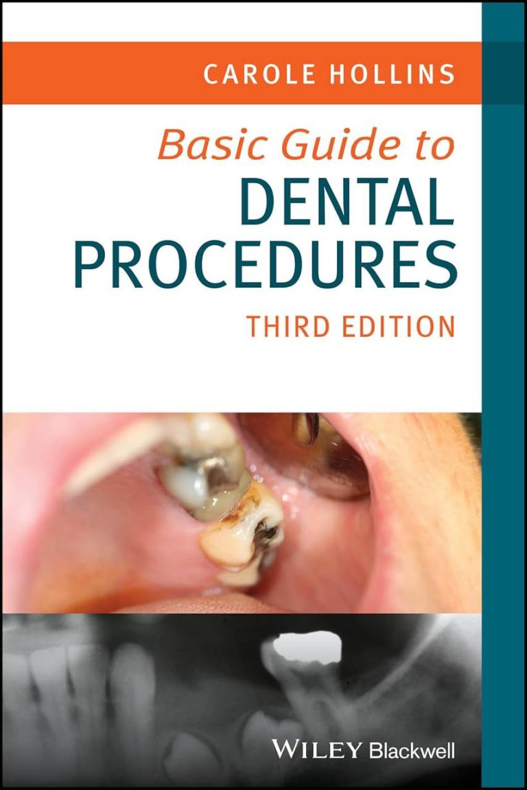 Basic Guide To Dental Procedures (Basic Guide Dentistry Series ...