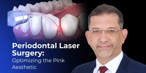 OHI-S Laser Periodontology Optimizing The Pink Aesthetic - MeduStudent